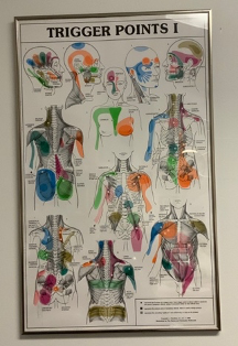 9. Trigger Points I and Trigger Points II - – Framed Posters - Planet ...