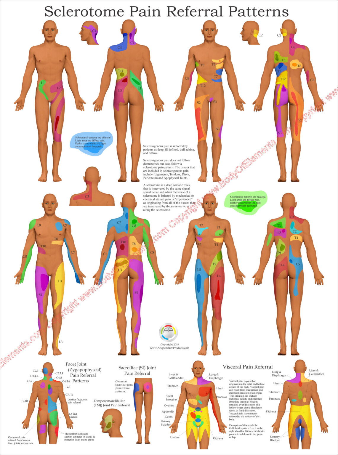 Sclerotome Visceral Pain Referral Poster - 18" X 24" - Planet Chiropractic
